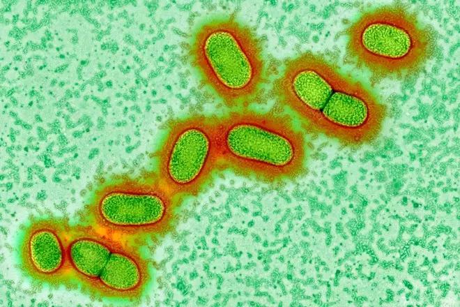 Sciencistoj trovis la kaŭzon de apero de Alzheimer kaj la manieron haltigi ĝin