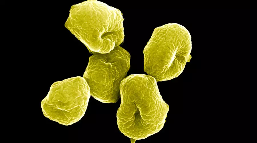 Archaea Wopikisana naye wamkulu wa ma tardigrade pankhondo yapadziko lapansi itatha nkhondo yankhondo. Archaea ndi ofanana kwambiri ndi mabakiteriya, koma mosiyana ndi otsirizawa, amatha kupirira 30,000 imvi. Mwa njira, mulingo woopsa kwa anthu umangokhala ma grays 5 okha. Mwambiri, a T. gammatolerans amakonda kukhala m'madzi otentha kutentha kwa 100 ° C! Asayansi sanathenso kuthana ndi chinsinsi ichi, ndipo njira zomwe zimalola kuti archaea ipirire zochuluka zotere sizinapezeke.