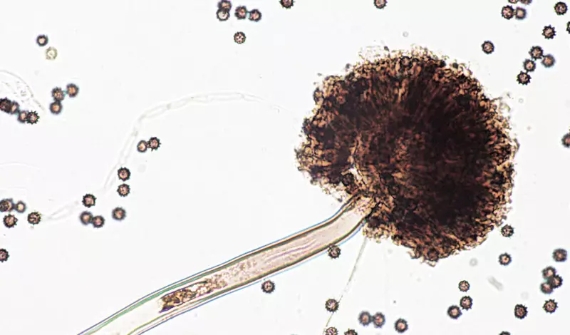 Habitat černé plísně: Zdi Vědecký název tohoto nepříjemného souseda je Aspergillus niger, černá plíseň, která se často skrývá pod stropem nebo za tapetou. Černá plíseň může způsobit řadu alergických reakcí: pokud je venku zima a alergie se stále objevuje, pečlivě zkontrolujte svůj byt. Ideální možností by bylo pokrýt všechny stěny speciálním antiseptickým základním nátěrem.