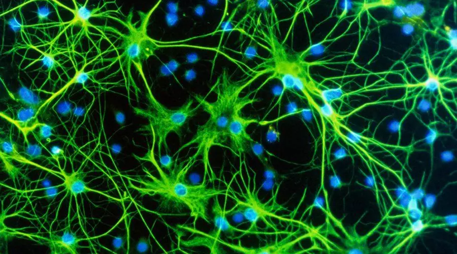 Estat nerviós Se sent constantment nerviós i pot causar un esclat? El més probable és que es tracti de la mateixa deficiència de calci. El sistema nerviós depèn molt d’aquest mineral: fatiga ràpida, distracció de l’atenció i ràbia sense causa, tot això.