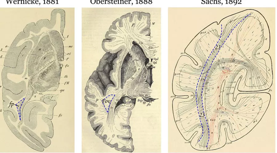 Paquet de nervis occipital vertical De fet, el primer paquet de nervis del cervell va ser descobert pel neuròleg alemany Karl Wernicke el 1881. Però el descobriment es va perdre en el temps i els científics el van “redescobrir” només el 2012. Aquest feix vertical de nervis occipitals ens ajuda a reconèixer i llegir paraules.