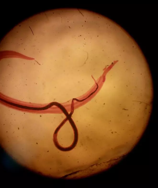 Dangerous experiment: in the Netherlands infected with parasites for 1000 euros