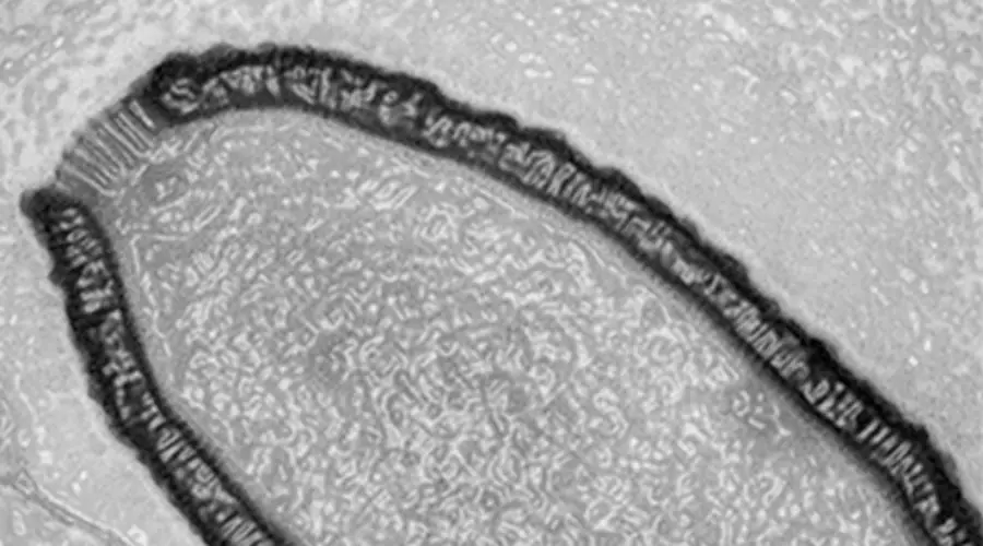 不気味なウイルスおそらく私たちのリストで最も厄介な発見。マルセイユ大学の科学者は、ロシアの生物学者とともに、シベリアの氷の中に巨大ウイルスを発見しました。この種の生物の場合、Pithovirus sibericumは単純に巨大で、その寸法は1.5x0.5ミクロンです。