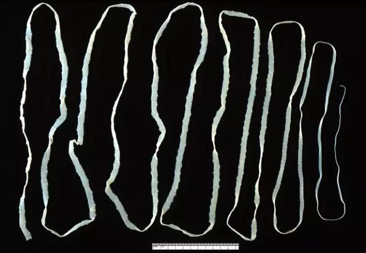 Teniarinhoz O axente causante da enfermidade é a tenia bovina, que pon as larvas na carne das vacas hospedadoras intermedias. A noxenta visión do enorme (7-10 m de lonxitude) e as desagradables consecuencias da infección con el deberían facer que todos os amantes da carne semifrita pensen dúas veces: como a maioría dos outros vermes parasitos, a tenia bovina morre cun tratamento térmico adecuado.