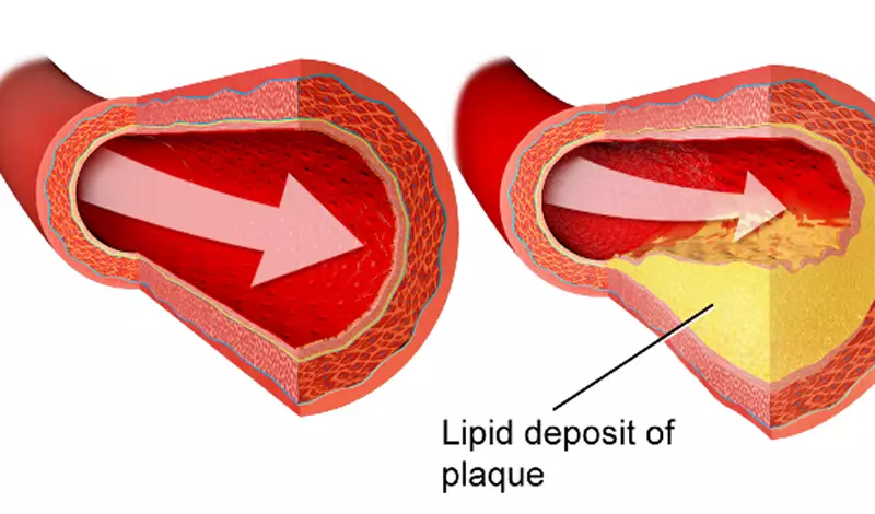 13 kiến ​​thức về cholesterol giúp kéo dài tuổi thọ 7694_1