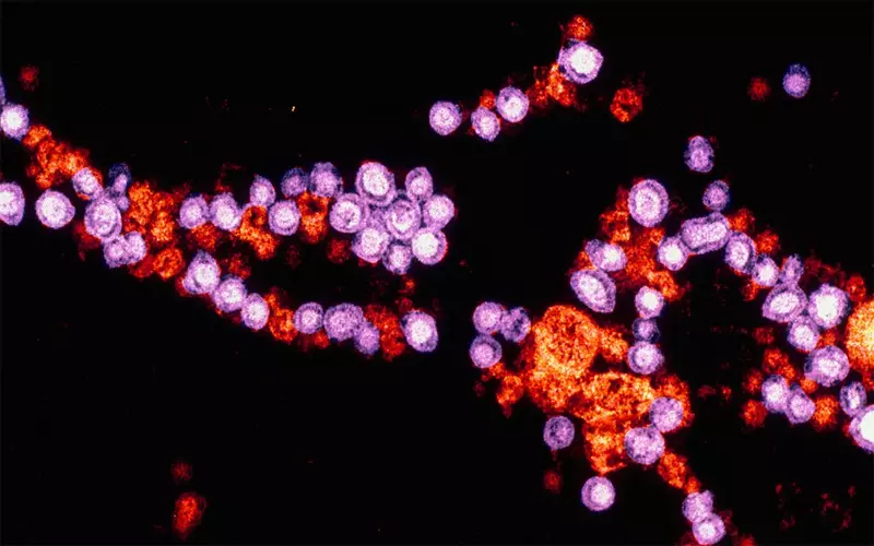 Rubella Rubella adalah penyakit masa kanak-kanak yang tidak terlalu berbahaya dan, bagaimanapun, cukup berbahaya. Seorang wanita yang terinfeksi pada awal kehamilan sangat mungkin untuk melahirkan anak yang dibebani dengan cacat lahir yang serius. Sekarang ada sekitar 120.000 kasus seperti itu setiap tahun. Tidak ada bukti apakah dokter akan mampu membasmi virus ini sepenuhnya.