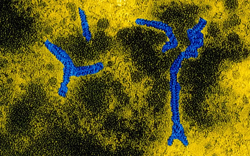 Mumps Nesrečna oseba, ki je okužila mumps, ima sprva precej značilne simptome prehlada: glavobol, bolečine v mišicah, utrujenost in izgubo apetita. Nato žleze slinavke nabreknejo in virus običajno nekaj tednov besni v krvi. To včasih vodi do resnih zapletov, kot so encefalitis ali meningitis, edem jajčnikov ali dojk (pri ženskah in dekletih, ki so dosegli puberteto), ter gluhost. Danes je ta bolezen praktično premagana. Še vedno pa obstajajo nepojasnjeni izbruhi mumpsa - zadnji je bil zabeležen pred šestimi leti v New Yorku. Potem je zbolelo približno 3500 otrok.