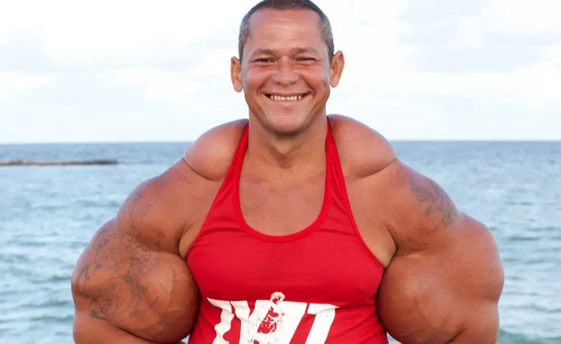 Synthol-Zusammensetzung besteht zu 85 % aus Öl. Die am häufigsten verwendeten sind Sesam und Kokos. 7,5% Lidocain als Anästhetikum; 7,5% Benzylalkohol - zur besseren Konservierung. Hallo große Muskeln. Tschüss, Leber und Nieren.