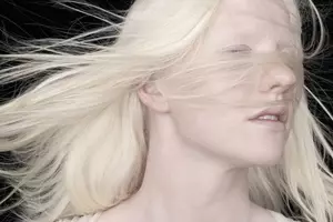 Albinos: ένα γενετικό φαινόμενο της φύσης