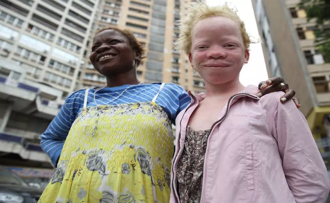 Sunstroke Albinos inogadzira vhitamini D zvakapetwa kashanu nekukurumidza kupfuura vanhuwo zvavo. Sezvo vhitamini D inoumbwa apo mwenje ye-ultraviolet-B inopinda mukati meganda, kusavapo kweruvara rweganda kunoreva kutsva kunenge kwakangoerekana kwaitika, kunyangwe muzuva rakareruka.