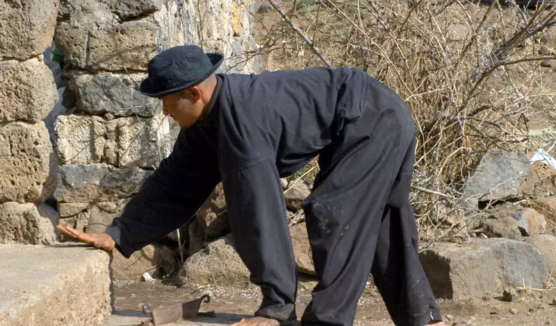 Sendroma Uner Tan Nexweşî bi navê biyologê evolusiyonê yê tirk, Uner Tan, hatiye binavkirin. Sendroma pir kêm kêm e - digel wê, mirov bi çar lingan dimeşin û ji paşketina giyanî ya giran dikişînin. Balkêş e ku hemî bûyerên nexweşî tenê li Tirkiyeyê hatine tomar kirin.