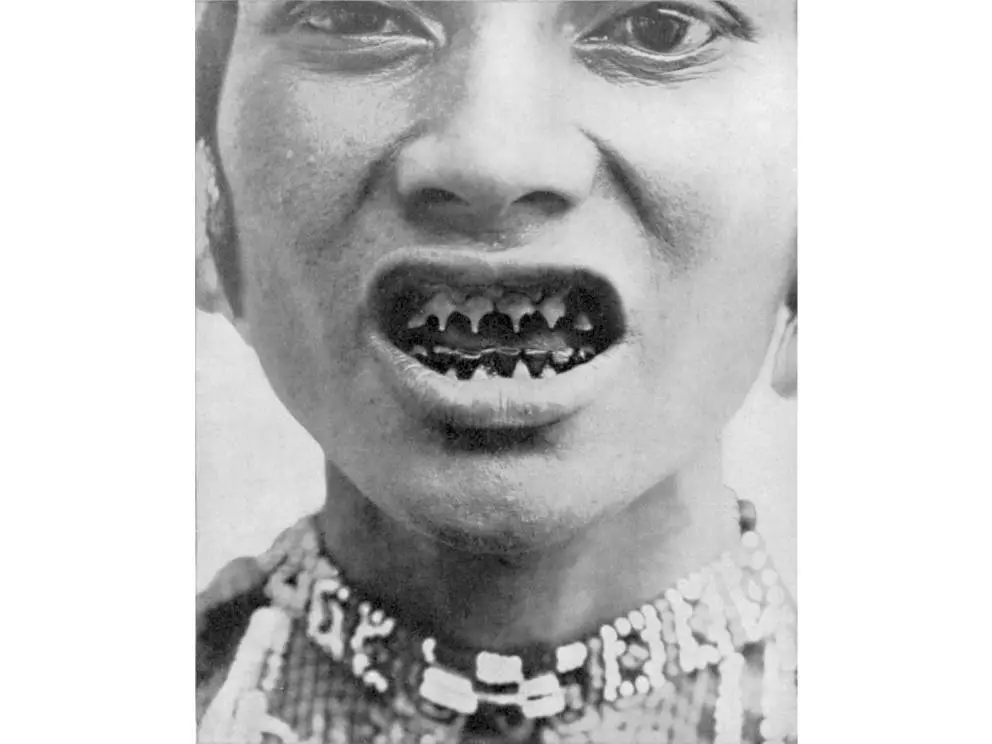 Dents pointues Mentawai La tribu indonésienne des Mentawai considère les dents pointues comme la norme de beauté. Plus une femme est fine et fine, plus une femme est désirable. Le rituel n'est pas du tout obligatoire dans la culture, mais de nombreuses filles le subissent à l'adolescence de leur plein gré afin d'attirer le sexe opposé.