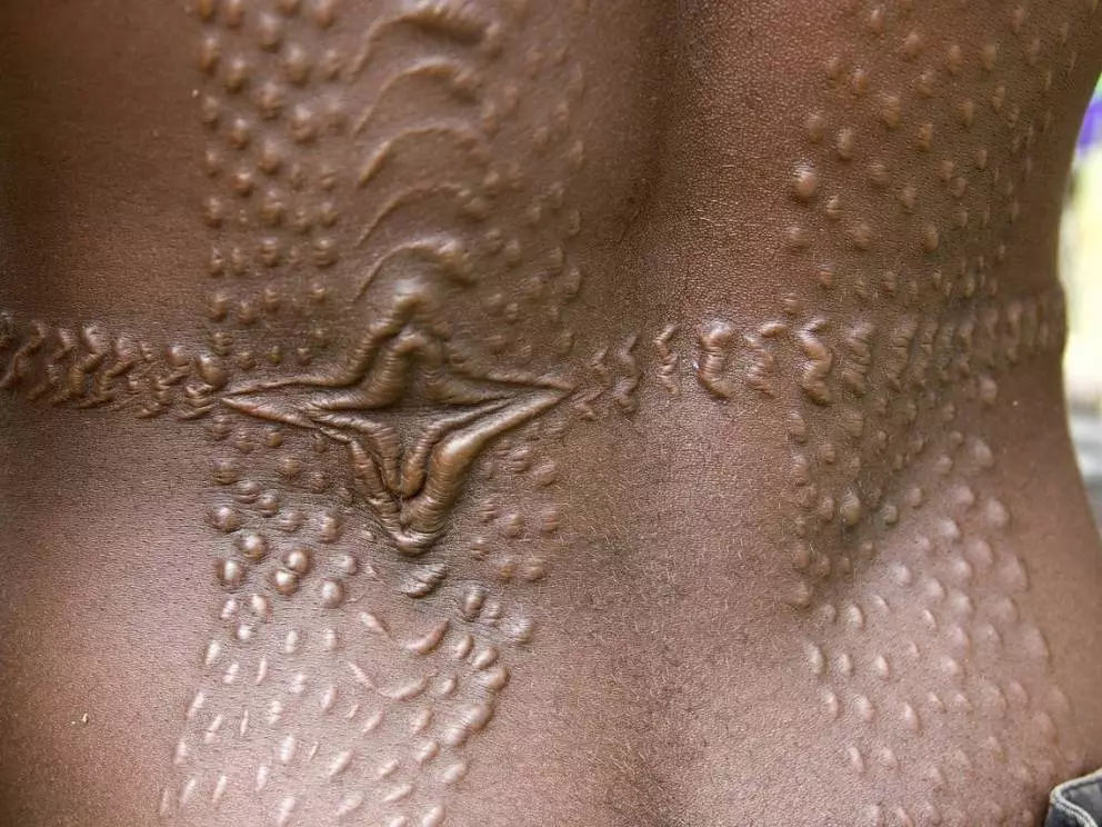 Scarification Sepik För Sepik -stammen i Nya Guinea är praxis med scarification heligt. Mönstren på tjejernas ansikten är gjorda för skönhet, de lakoniska linjerna på pojkens kinder visar styrka och mod. Initieringen av en vuxen jägare går också genom scarification: de äldste dekorerar ryggen på framtida krigare med likheten av krokodilskalor.