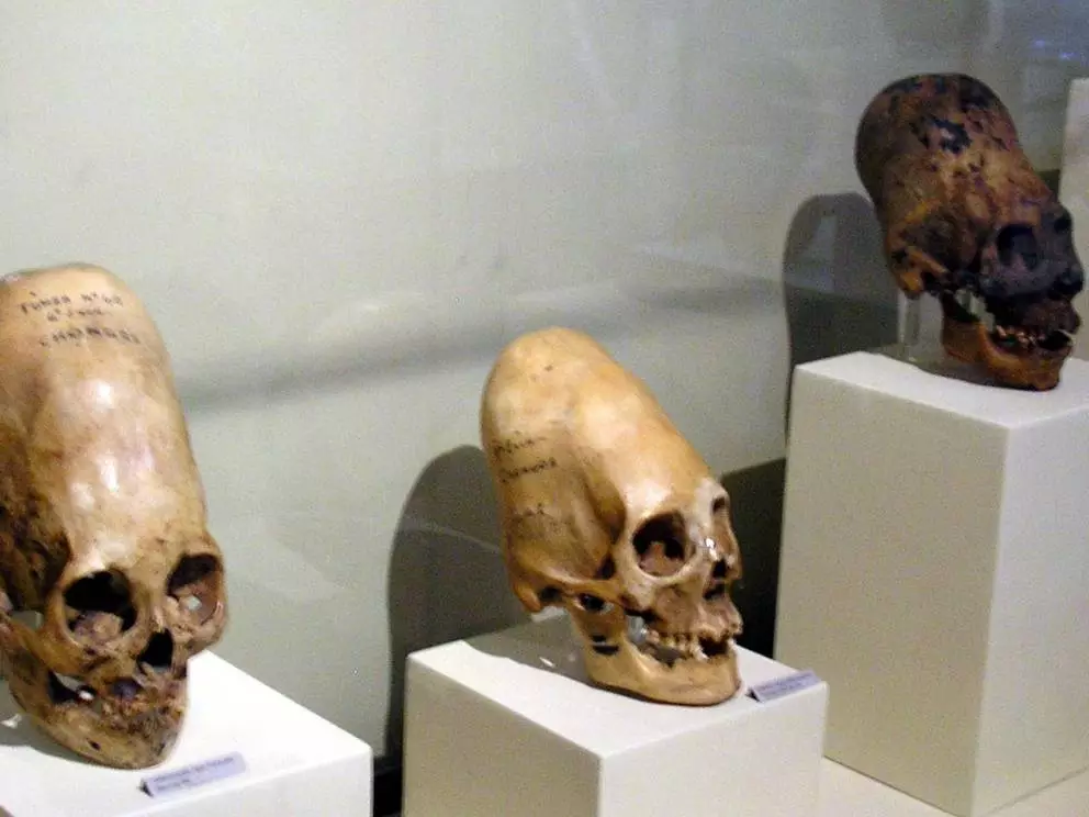 Cranio longo Perú Este ritual practicábase hai 45.000 anos nas antigas culturas peruanas. Desde a infancia, as caveiras dos nenos estaban envoltas en pano para dirixir o crecemento cara arriba. Ao parecer, só os fillos de familias ricas estaban expostos a isto.