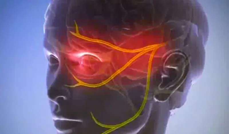 Trigeminal neuralgia የ trigeminal ነርቭ እብጠት ህመም እስከ ብዙ ሰዓታት ሊቆይ ይችላል። እሱን የፈተኑት ስሜቶቹ መብረቅ እንደመታዎት በግምት ተመሳሳይ መሆናቸውን ያረጋግጣሉ። በሽታው በጭራሽ ሊታከም አይችልም -ምልክቶቹን ብቻ ማቃለል እና ውስብስብ ችግሮች እንዳይከሰቱ ማረጋገጥ ይችላሉ።