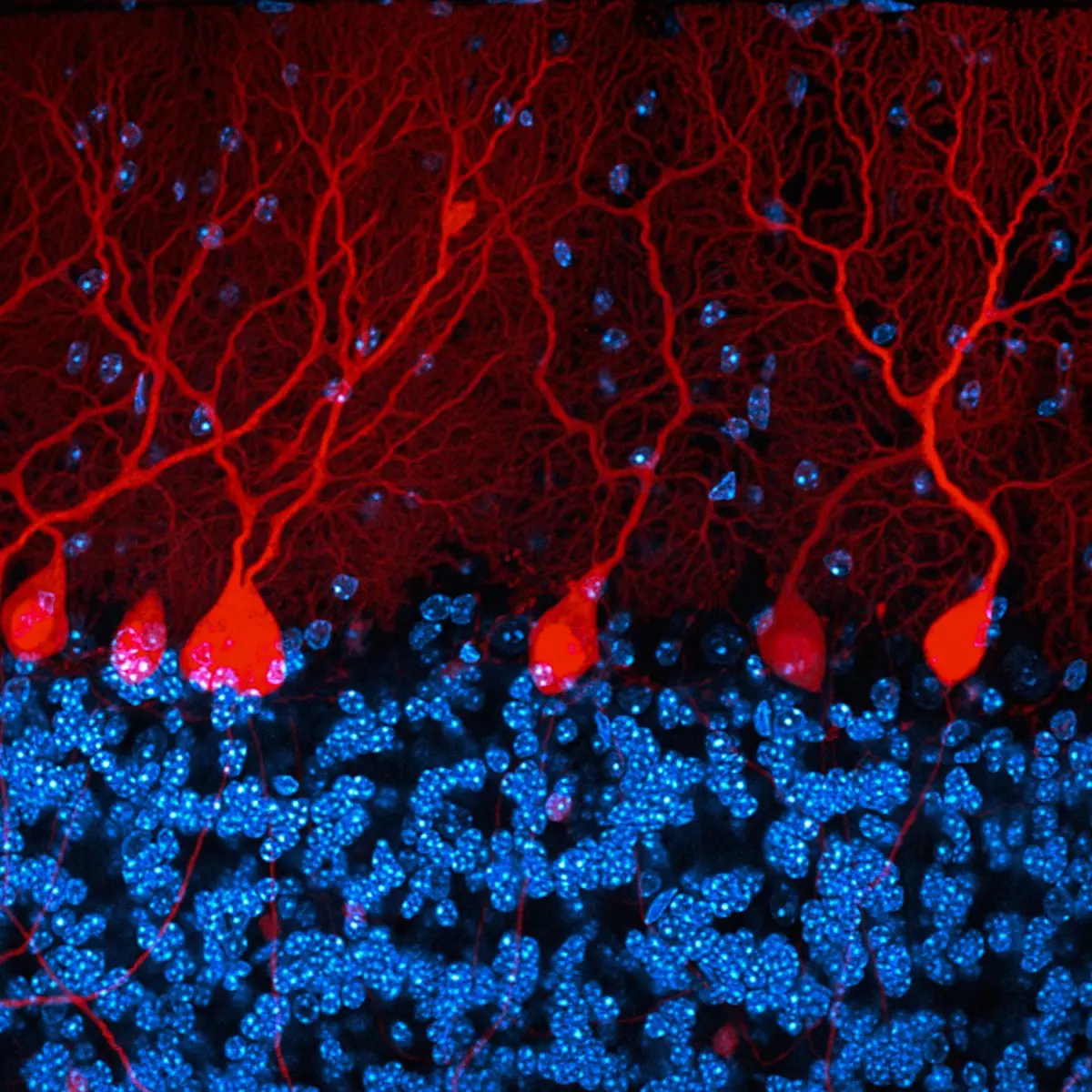 Indaba yobuchopho yegundane le-transgenic ku-3D