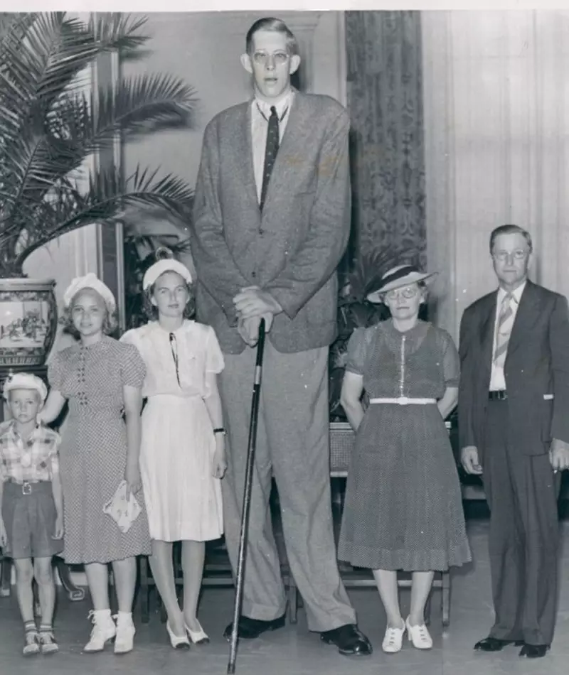 Robert Wadlow 2 metri 72 centimetri L'ipertrofia ipofisaria ha causato livelli anormalmente elevati di ormone della crescita umano nel corpo di Robert. Il "gigante dell'Illinois" era alto tre metri e, per evitare che il vento soffiasse fuori strada, ha guadagnato fino a 220 kg di peso. Il surplus di ormoni era così grande che il corpo di Robert continuò a crescere anche dopo la morte registrata della sua mente.