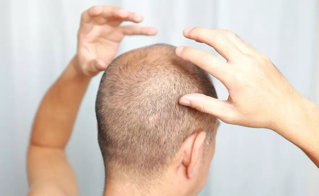 Hair loss Cold is thought to be bad for the scalp. Hair actually becomes drier and more brittle. But at the same time, they begin to grow faster and become thicker: the body protects itself from the cold in the same way as it did in the distant past.