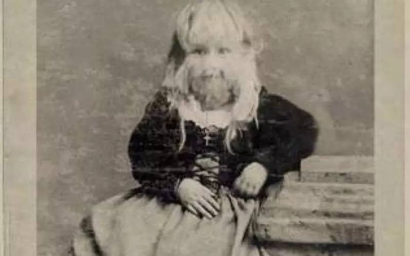 Alice Doherty "Werewolf oa Minnesota" Alice Elizabeth Doherty o hlahile ka 1887 Minnesota, USA lelapeng le neng le kile la ba le bana ba nang le chebahalo e tloaelehileng. Ha a hlaha, sefahleho sa Alice se ne se se se koahetsoe ke moriri ka bolelele ba lisenthimithara tse 5. Batsoali ba hae ba ile ba hlaphoheloa kapele 'me ba qala ho bontša morali oa bona chelete kapele. O ne a hiriselitsoe barekisi ba behang ngoanana eo pontšong ho hohela bareki. Alice ka boeena, eo, ka tsela eo, a ileng a fuoa lebitso la bosoasoi "American Werewolf", o ne a sa rate bophelo ba moholu oa mabenkeleng, ka hona a le lilemo li 18 a tlohela mosebetsi, a fumane chelete e makhethe esale pele.