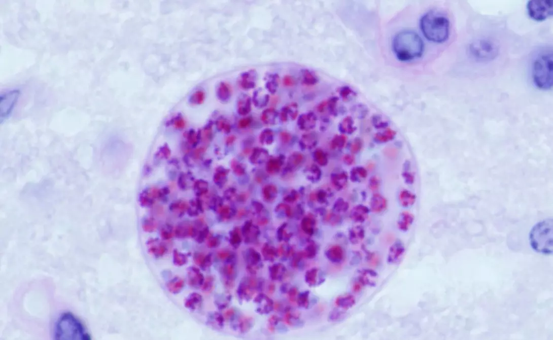 Forskere har bevist at fra 30% til 50% av verdens befolkning kan være bærer av toksoplasmose
