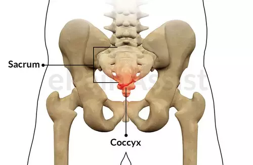 Coccyx Fanomezana iray hafa avy amin'ireo razambenay taloha izay nila rambony hitazomana ny fandanjana. Rehefa avy niarina ilay olona dia nianjera ny rambony ary taolana sisa no tavela. Tsy azo atao ny manaisotra azy satria voafatotry ny ligamenta, hozatra ary hozatra maro izy.